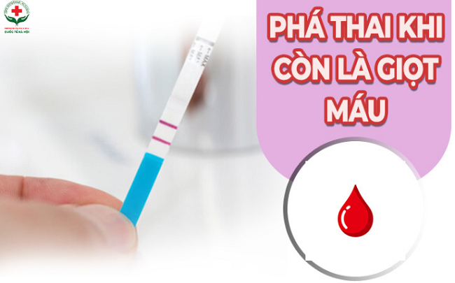 Máu báo thai- Phá thai khi còn là giọt máu bằng phương pháp nào?